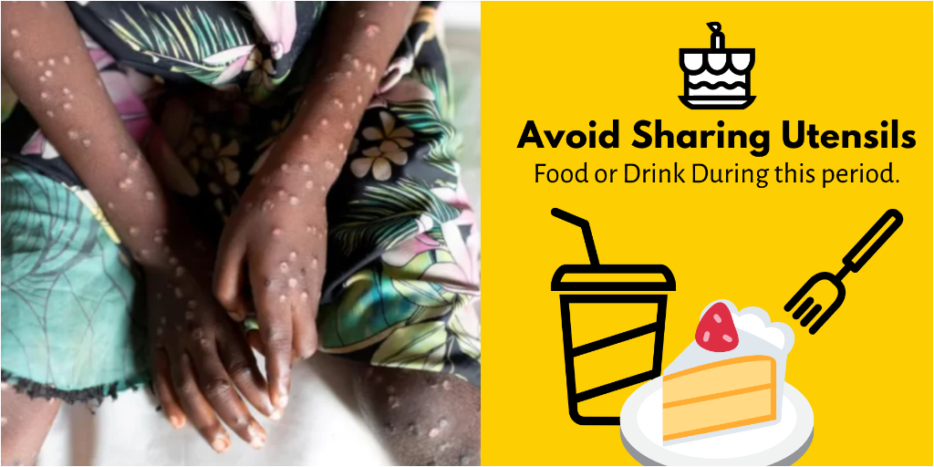 7 Easy Ways to Protect Yourself Against Mpox in Nigeria | Zikoko!