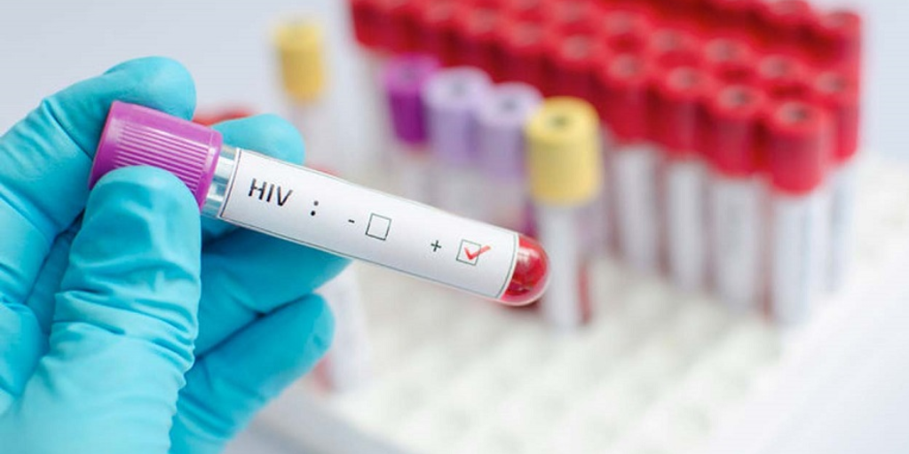 US Issues Waiver for Continuation of PEPFAR-funded HIV Treatment in ...